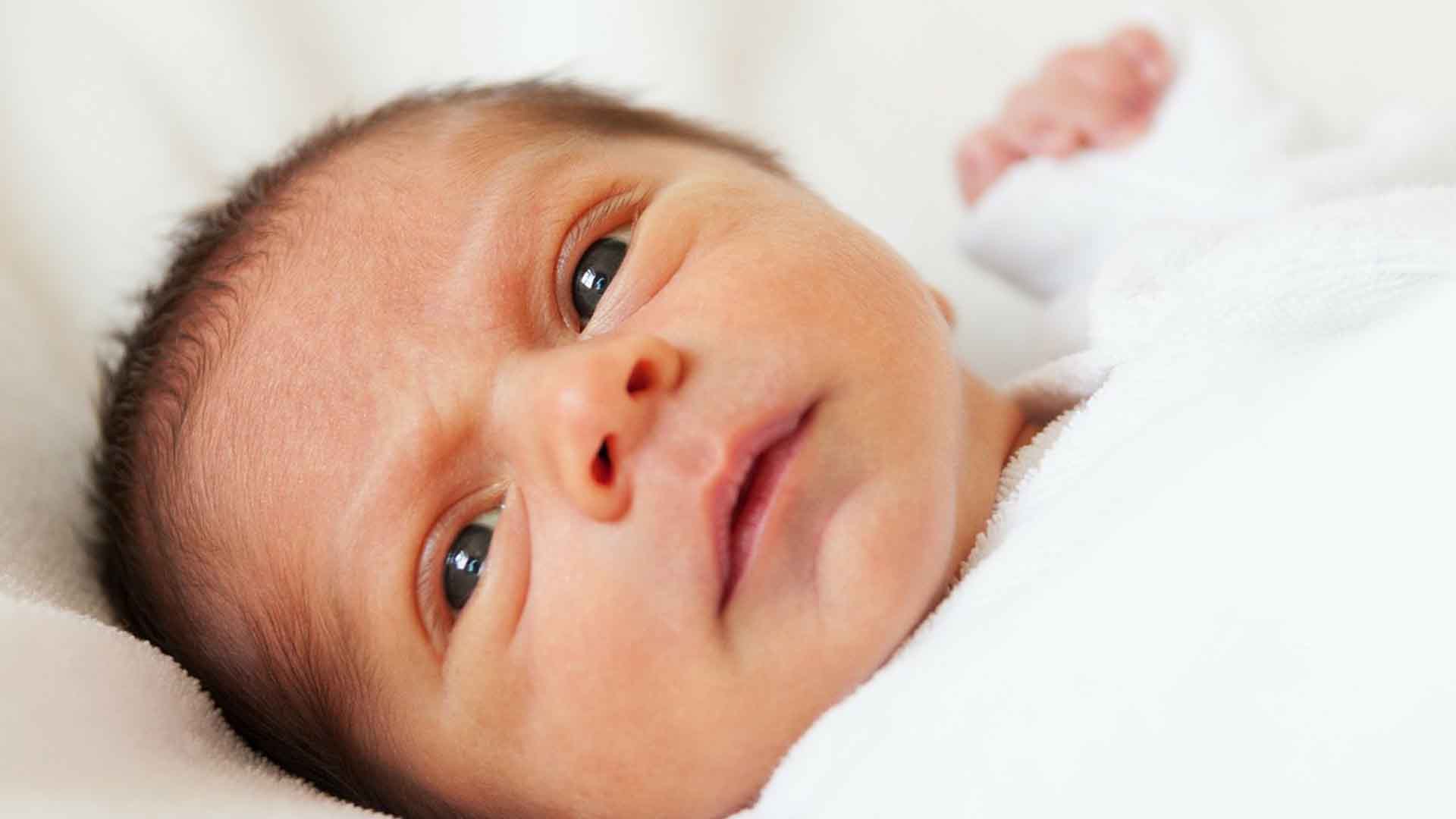 Cradle Cap Penyebab Ketombe Pada Bayi SensiCare